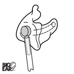Custom Stethoscope Adapters | Stethoscope Adapters | Big Ear